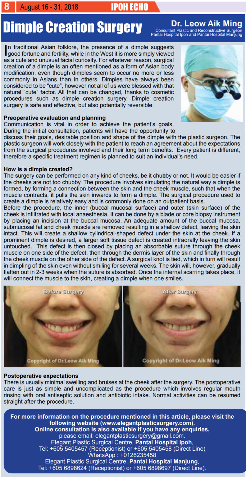 Dimple Creation Surgery - Elegant Plastic Surgical Centre in Ipoh ...